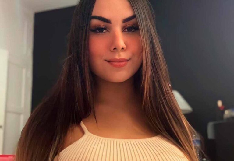Lipedema: forstå sykdommen som påvirker influencer Victoria Matos - Ela ...